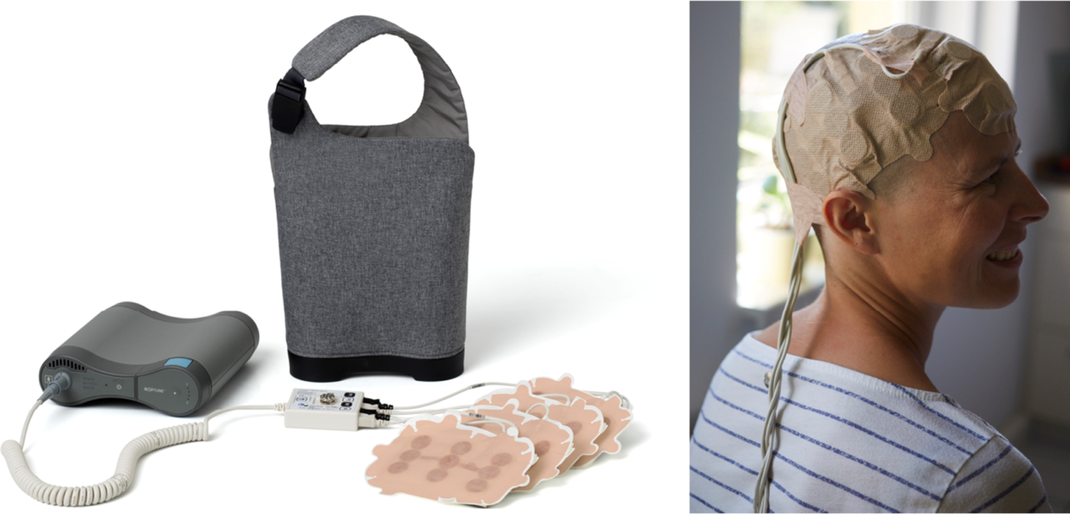 MTP-rådets uppdaterade rekommendation: Regionerna bör erbjuda Optune ...